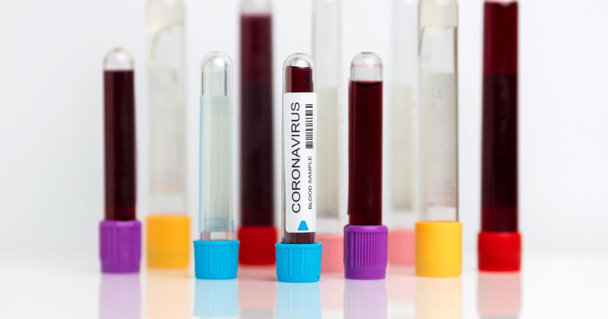 Plasma and hyperimmune… - Centre for Biopharmaceutical Excellence